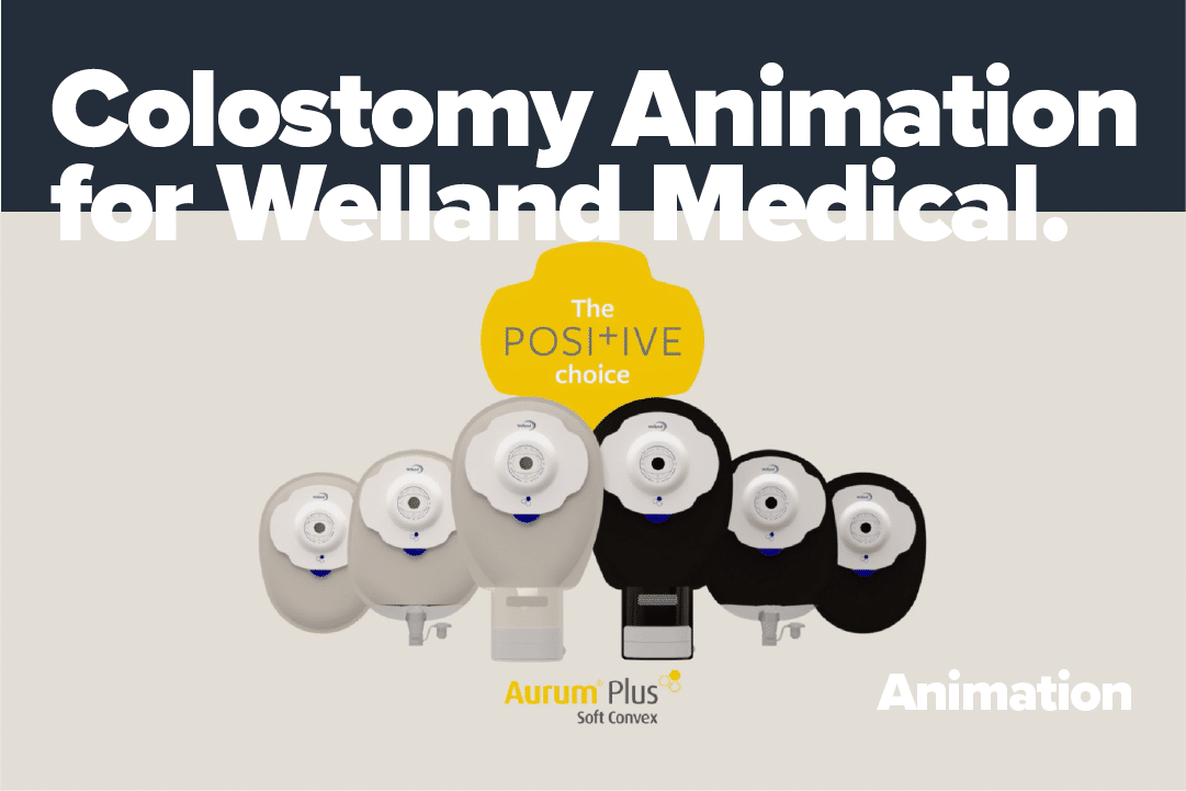 Colostomy Animation for Welland Medical! | Eon Visual Media